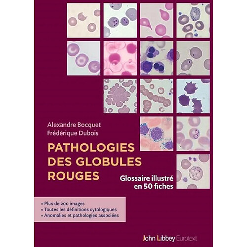 Pathologies des globules rouges : glossaire illustré en 50 fiches ...
